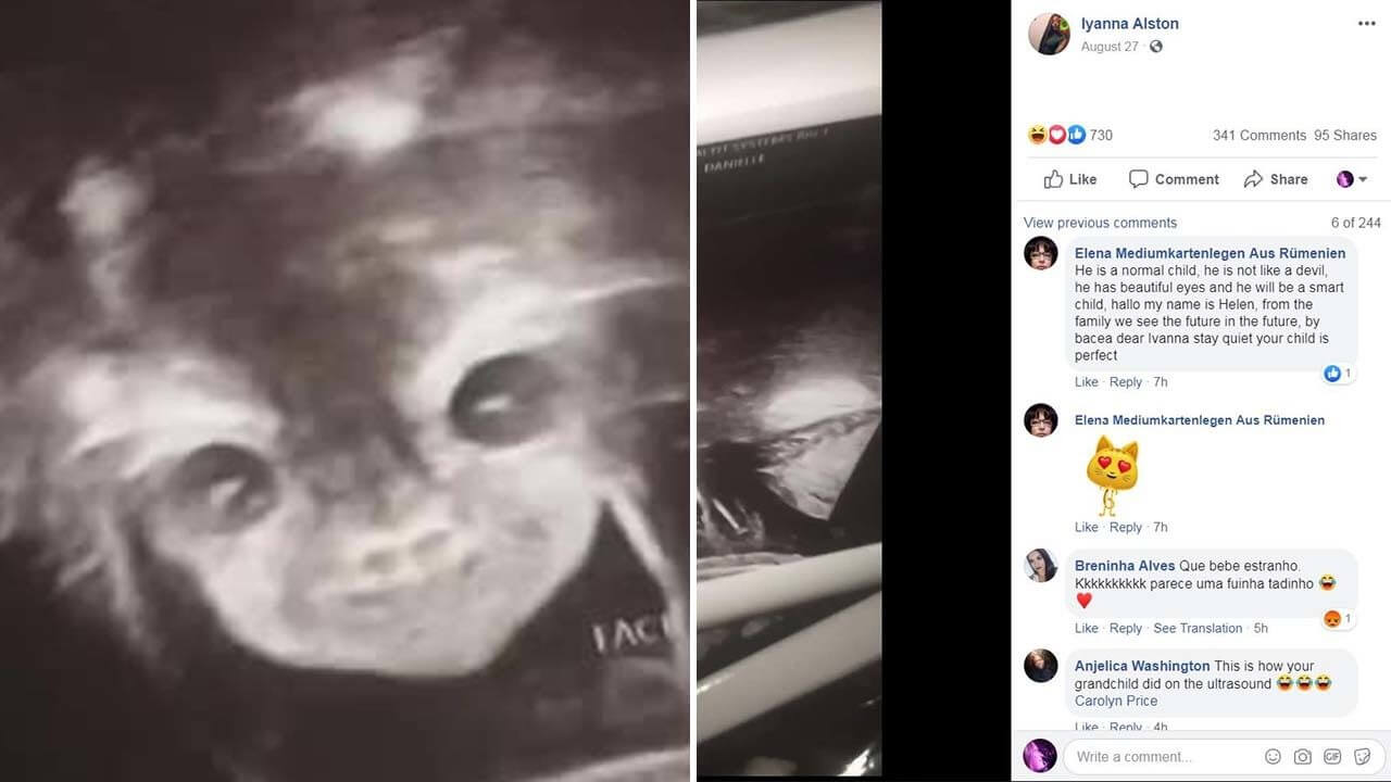 Shkon të bëjë ultratinguj dhe sheh "fantazmën" në bark - pernenat.al